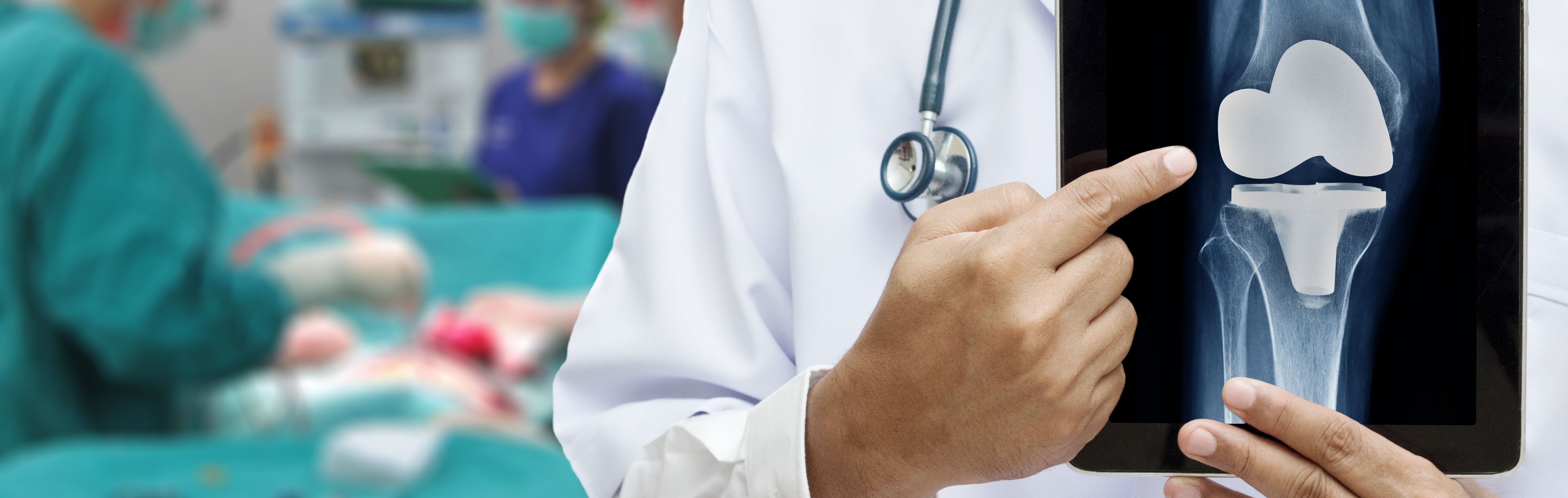 Download the Knee Replacement Recovery Timeline